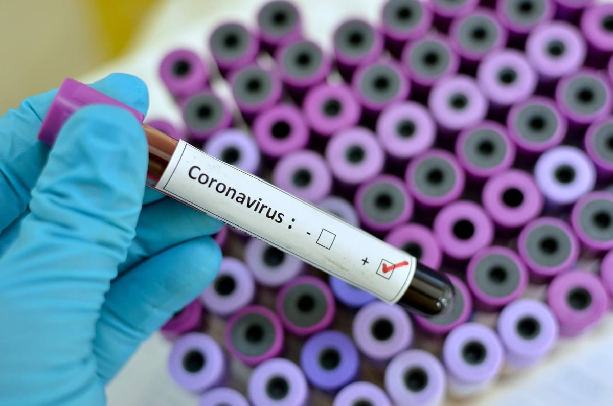 Event Planning in an Outbreak - Gogather